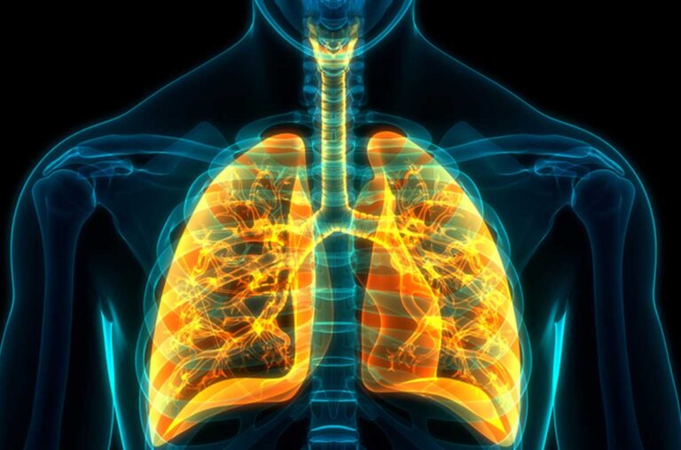 Respiratory health risks from workplace dust exposure - DustCanary ...